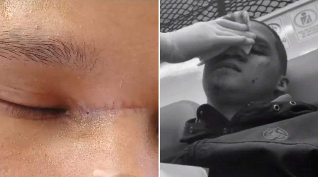 Motoristas inician campaña en contra del hilo curado para evitar ...